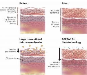 Agera Rx skin peels at Cheshire Lasers Clinic Middlewich.
