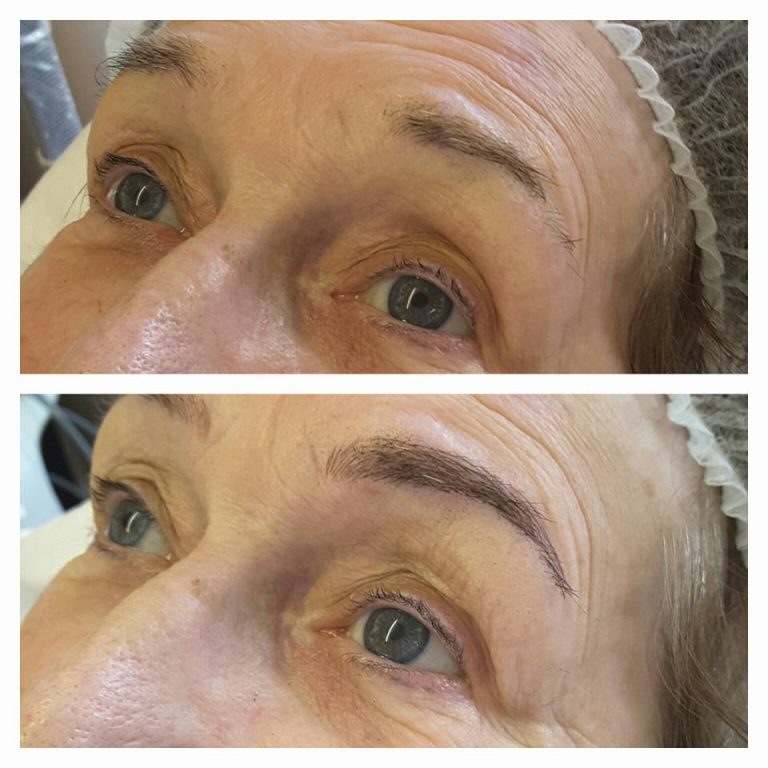 Microblading with Helena Fryer at Cheshire Lasers, Middlewich.