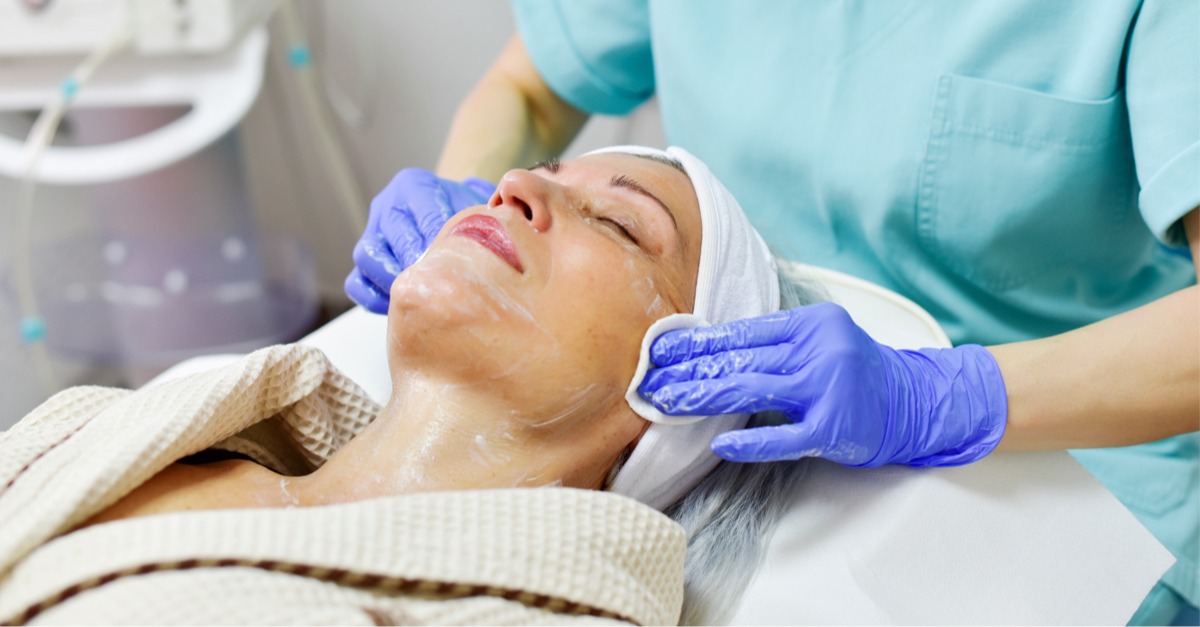 pHformula TCA Touch Treatment at Cheshire Lasers