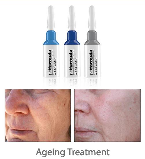 pHformula Skin Resurfacing