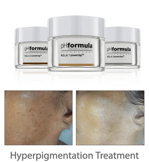 pHformula Skin Resurfacing