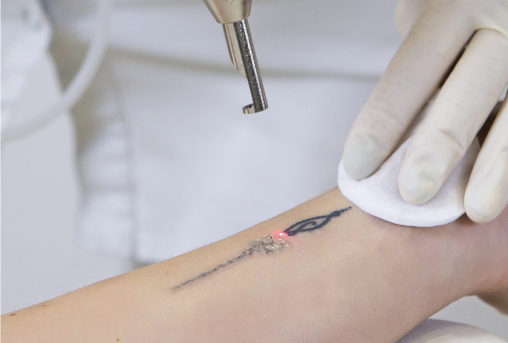 Cheshire Lasers - Medical, Health and Beauty Clinic in Middlewich